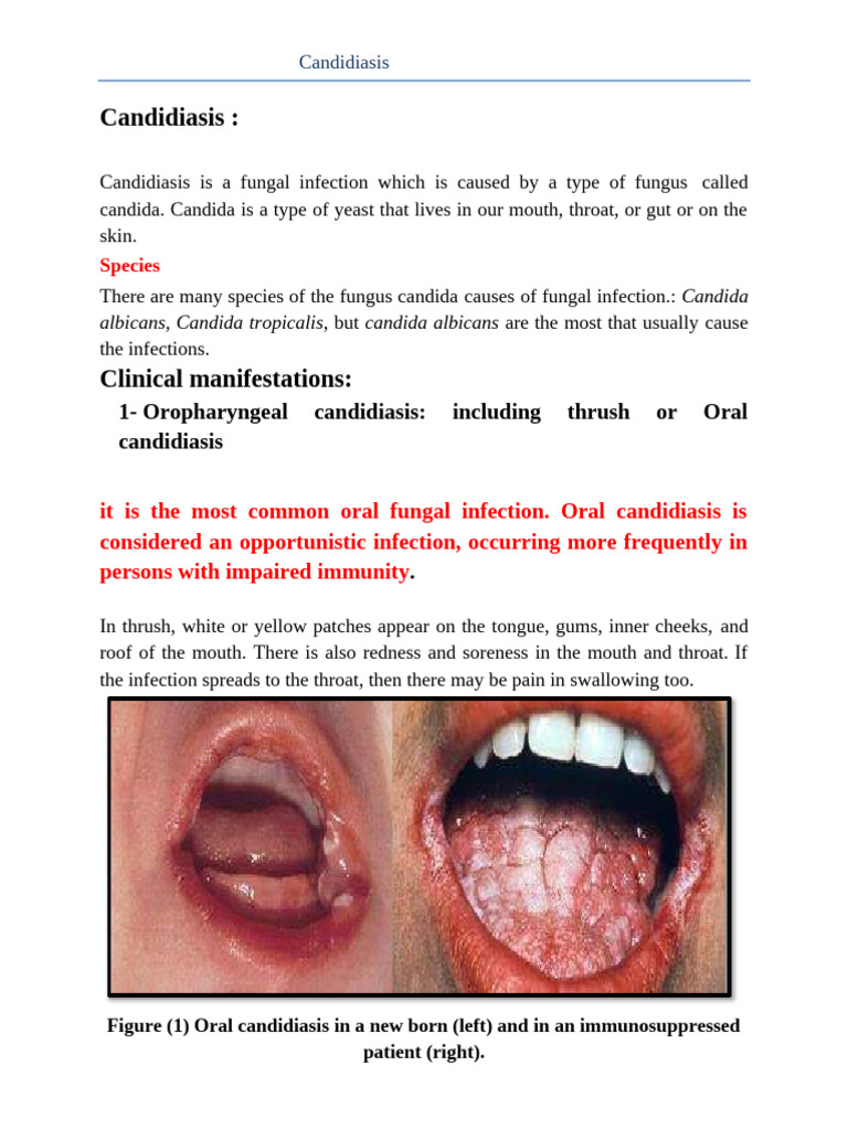 candida albicans | PDF | Candidiasis | Candida (Fungus)