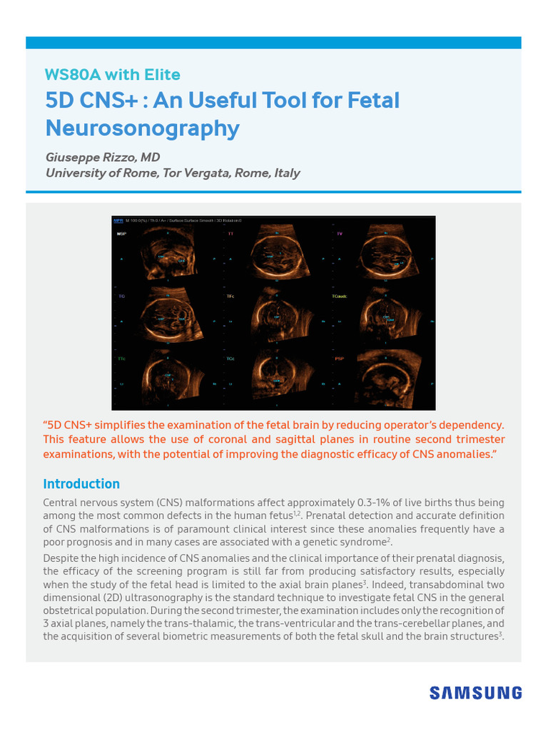 White Paper 5D CNS WS80A 2016 | PDF | Medical Ultrasound | Medical ...