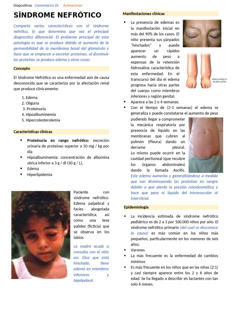 Síndrome Nefrótico | PDF | Edema | Especialidades Medicas