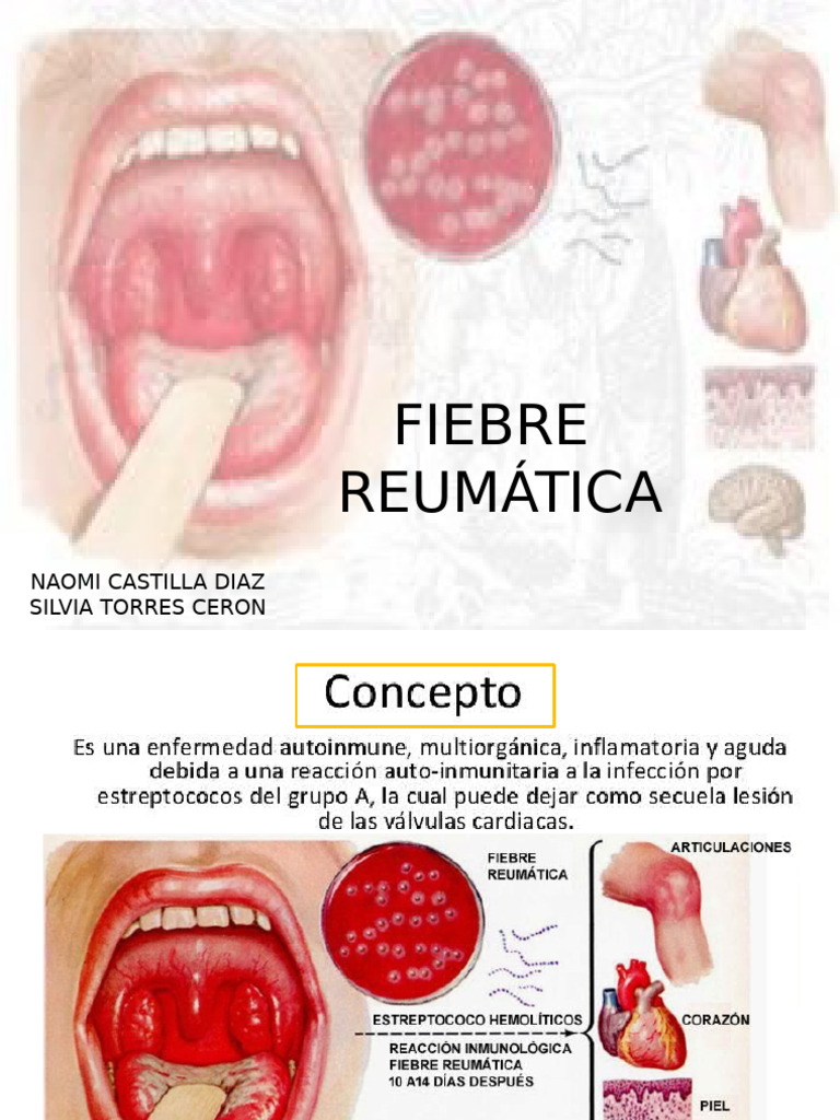Fiebre Reumática | PDF | Especialidades Medicas | Inmunología