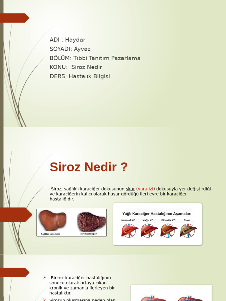 Haydar Ayvaz Siroz | PDF