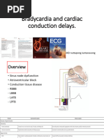 Understanding Heart Blocks and AV Disorders | PDF | Cardiac Arrhythmia ...