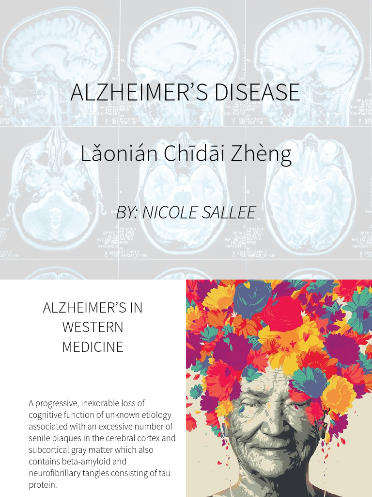 Alzheimer's PRESENTATION | PDF | Alzheimer's Disease | Dementia