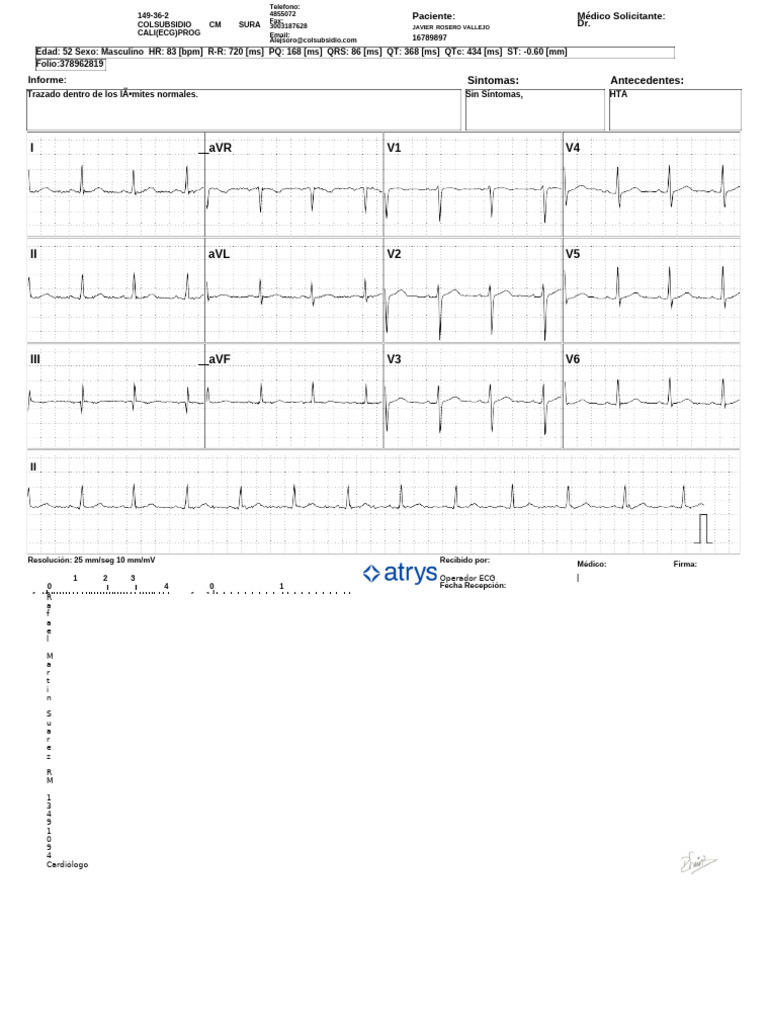 Ekg Normal | PDF