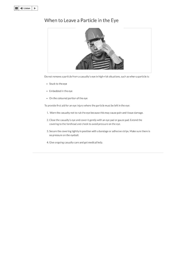 11.4 When To Leave A Particle in The Eye | PDF