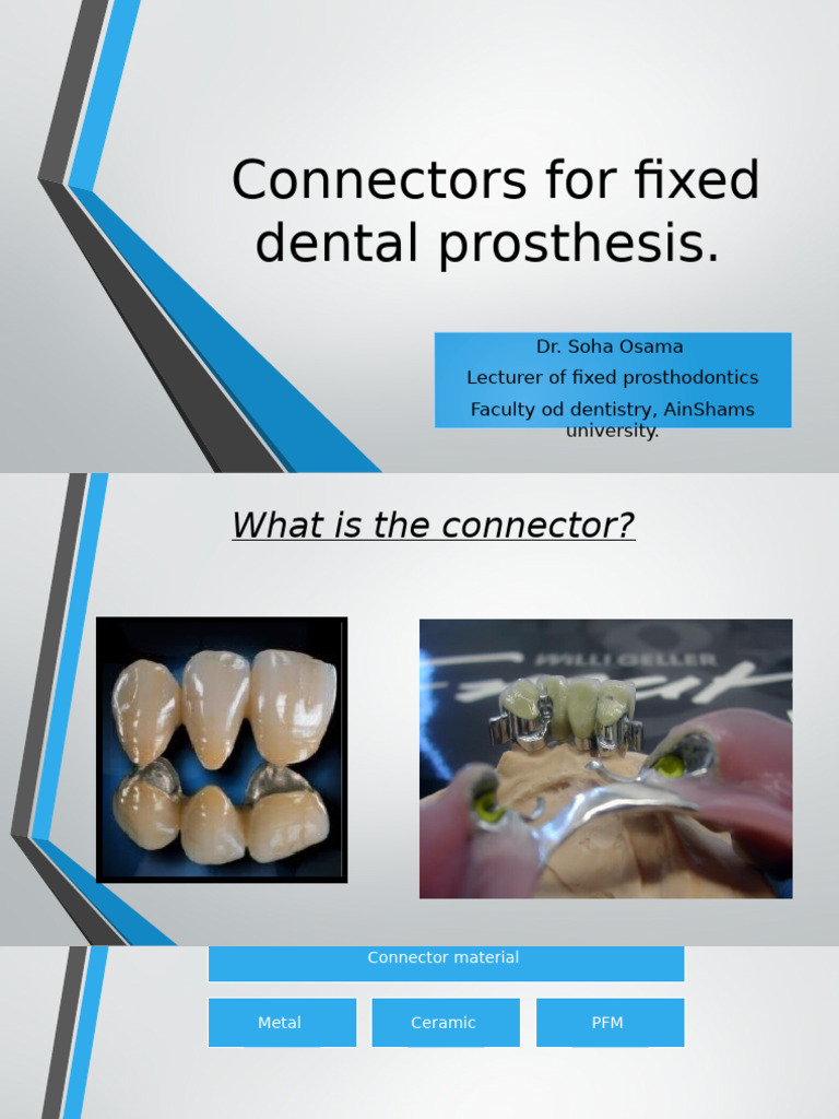 Connectors in Fixed Partial Dentures | PDF | Soldering | Materials