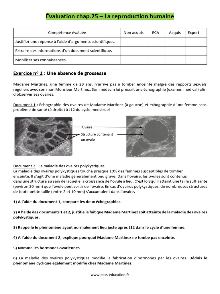 Évaluation sur la reproduction humaine | PDF | Syndrome de Stein ...