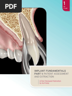 Catalog Frialit Xive | PDF | Dental Implant | Prosthesis