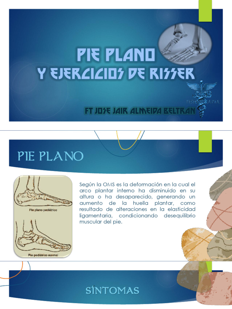 PIE PLANO Y EJERCICIOS DE RISSER Final | PDF | Pie | Corriendo