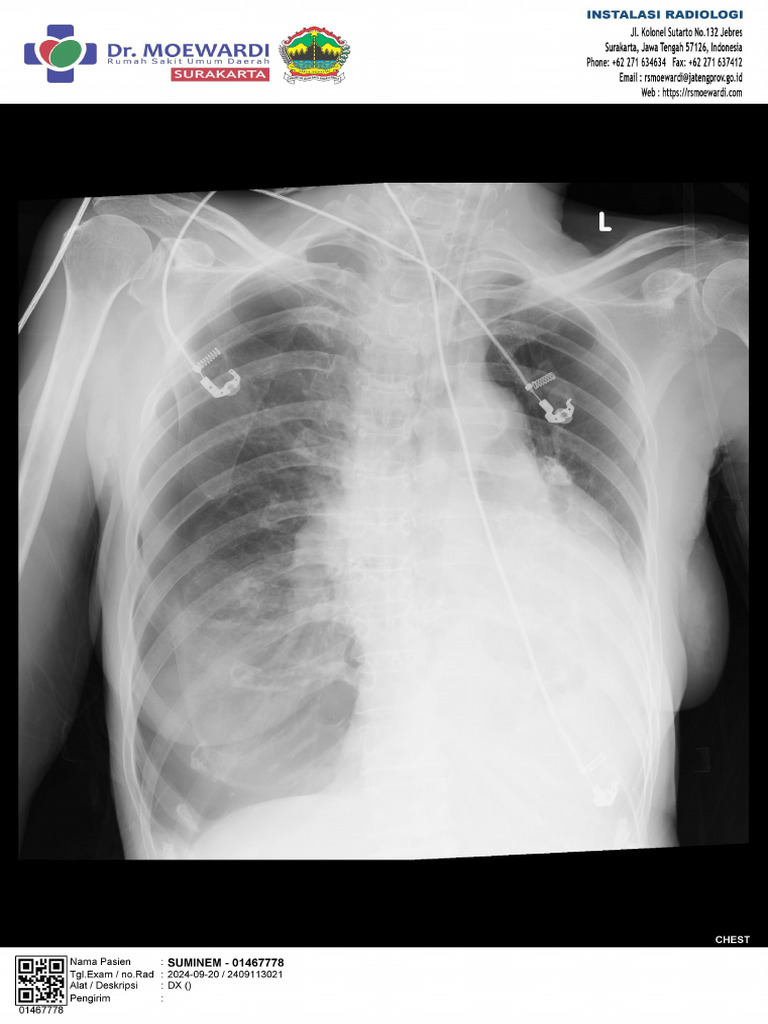 Suminem Ro Thorax 200924 | PDF