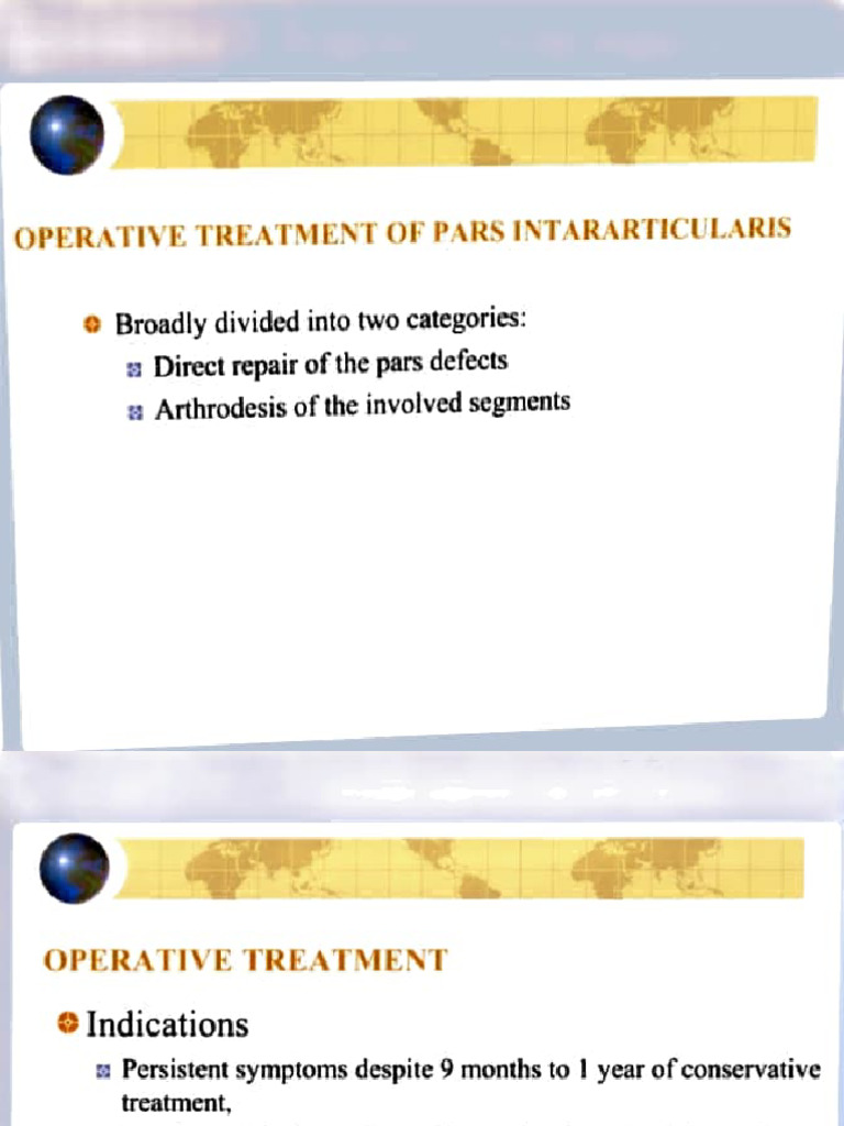 Operative Treatment for Pars Interarticularis | PDF | Vertebra ...