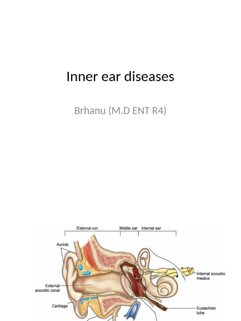 Inner Ear | PDF | Tinnitus | Vertigo