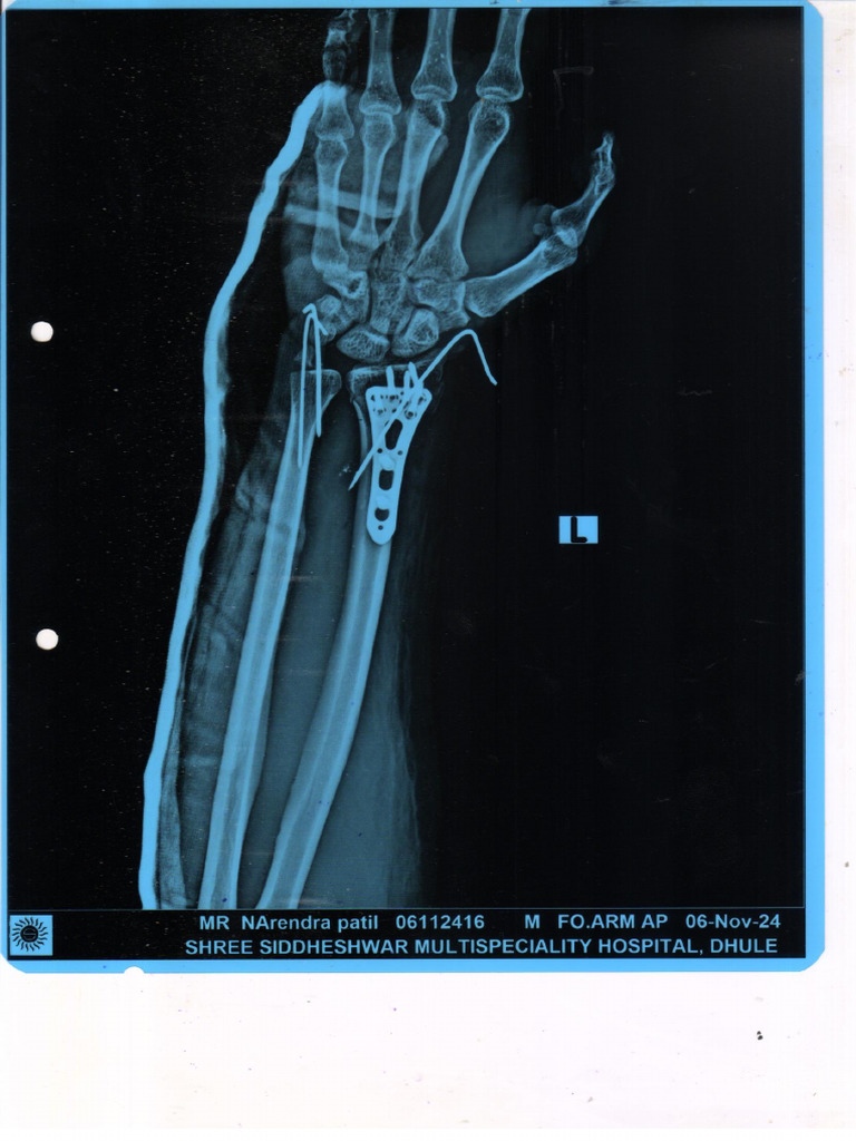 Post Op X Ray | PDF