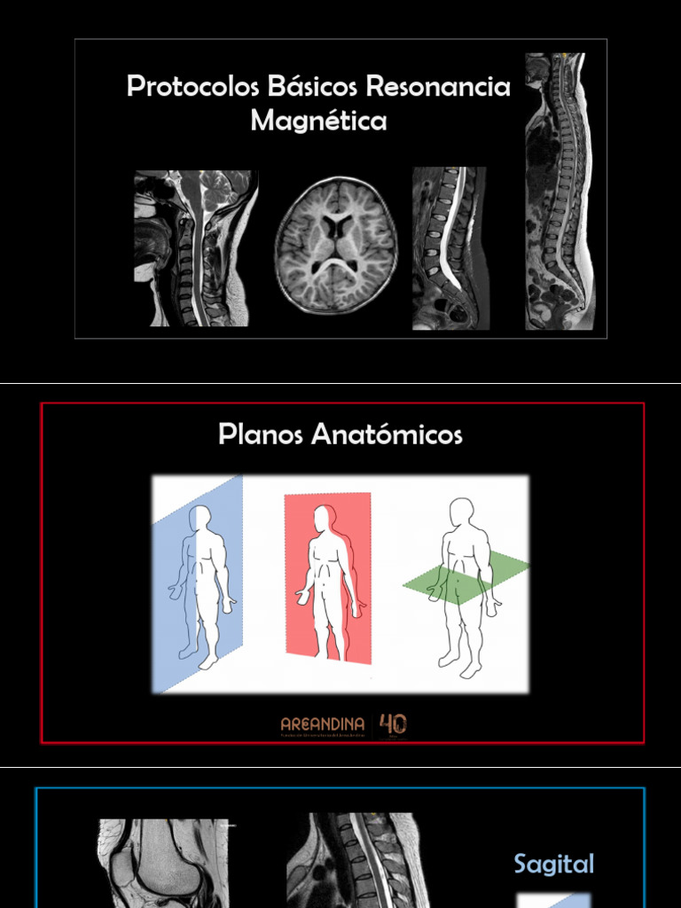 Protocolos BÃ¡sicos Resonancia MagnÃ© Tica PDF | PDF | Hombro | Rodilla