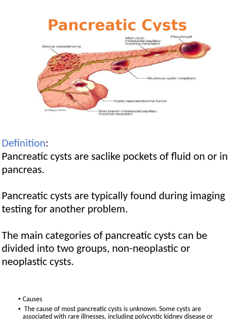 Pancreatic Cysts | PDF | Pancreas | Causes Of Death