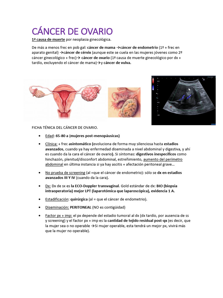 CÃ - NCER DE OVARIO Paula | PDF | Neoplasias | Ovario