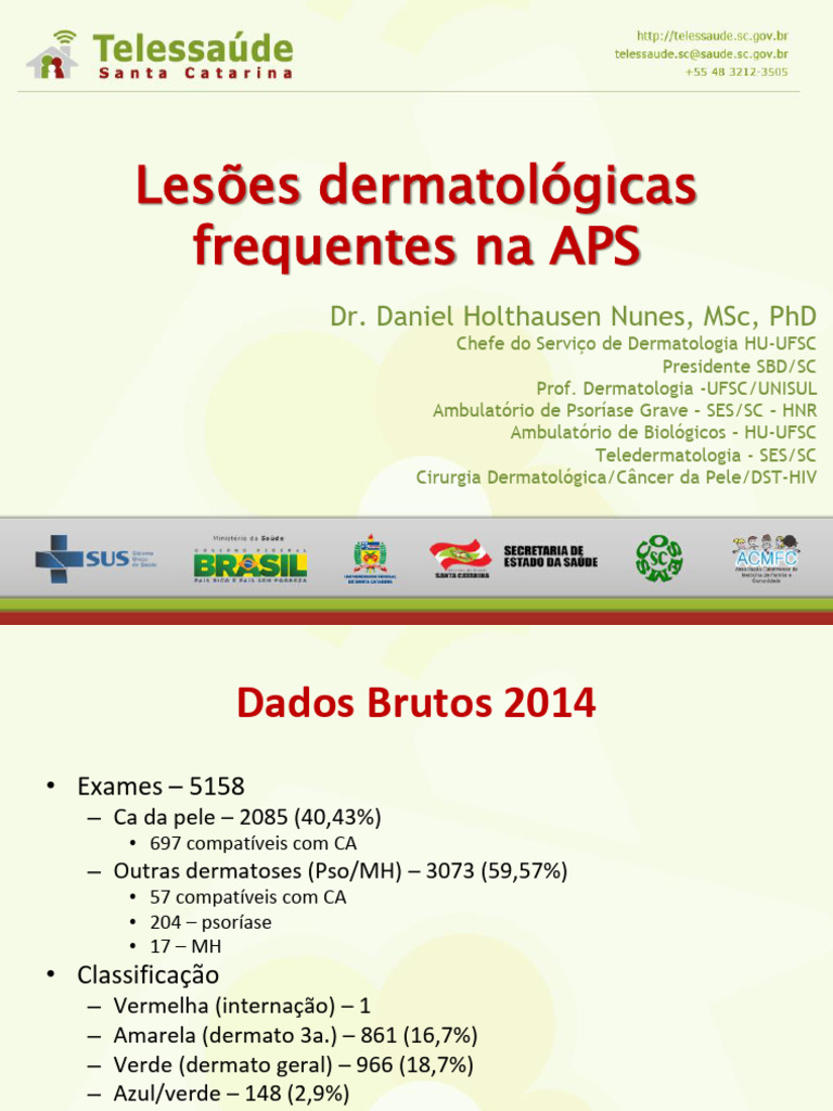Lesões Dermatológicas na APS | PDF | Melanoma | Carcinoma