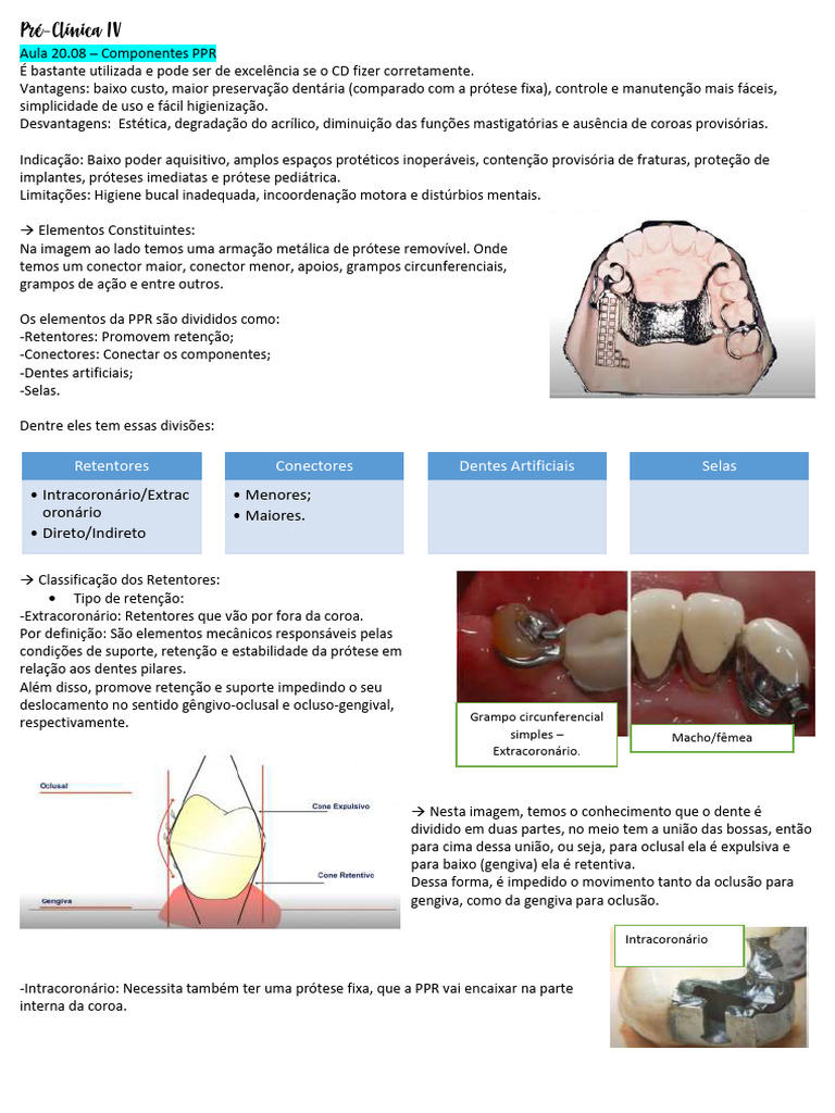 Componentes e Classificação da PPR | PDF | Dente humano | Prótese