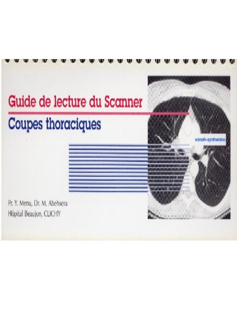 Guide Scanner Thoracique | PDF