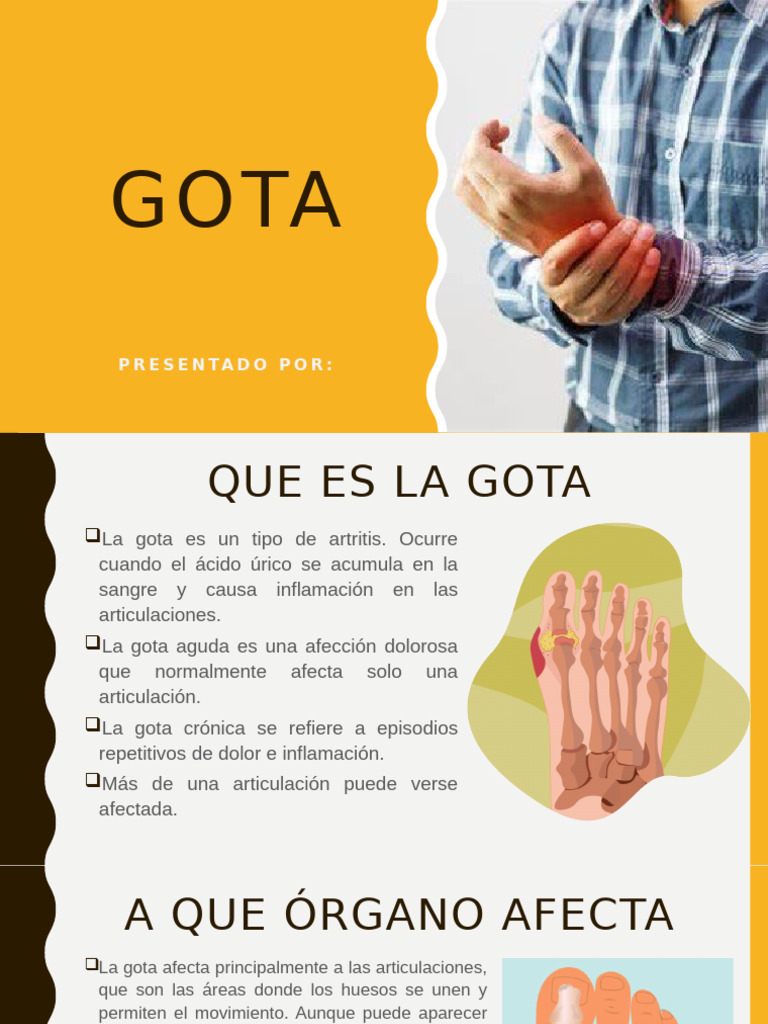 Gota | PDF | Gota | Medicina CLINICA