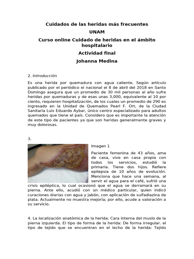 Tratamiento de Quemaduras por Escaldadura | PDF | Herida | Quemar
