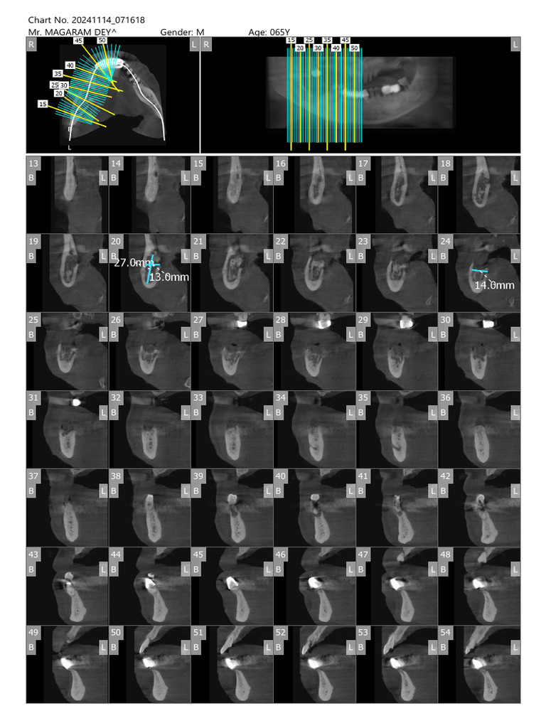 RBD Magaram Dey | PDF
