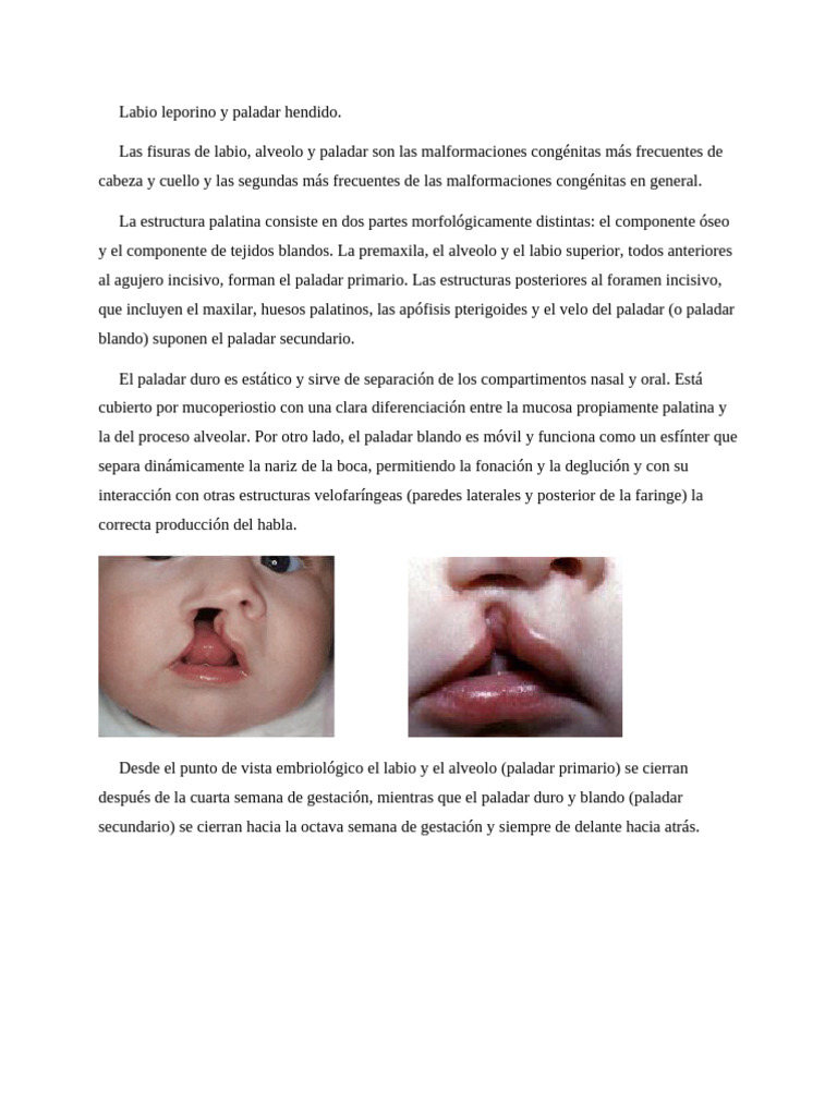 Malformaciones Congénitas: Labio y Paladar | PDF | Anatomía humana ...