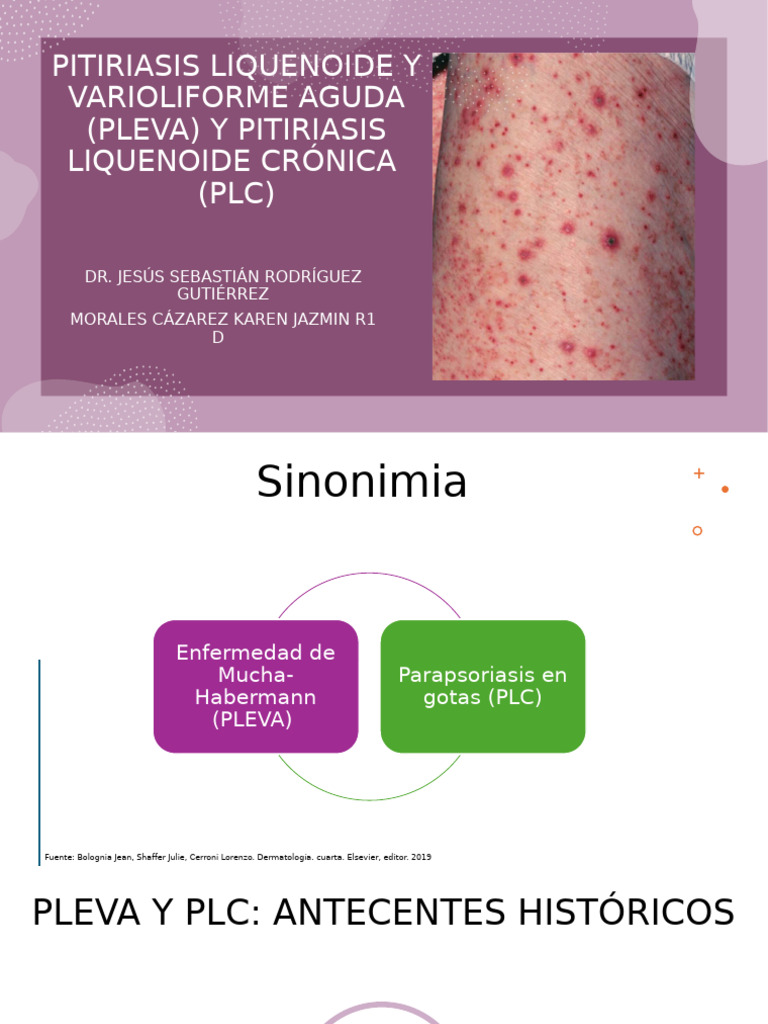 Pitiriasis Liquenoide y Varioliforme Aguda (Pleva) | PDF | Inmunología ...