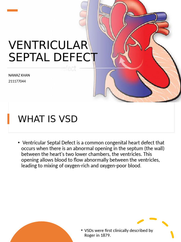 Ventricular Septal Defect-Nawaz Khan | PDF | Ventricle (Heart ...
