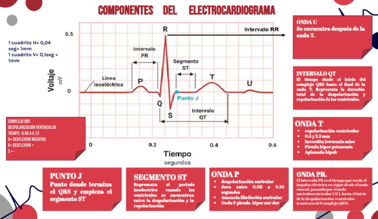 Componentes del Electrocardiograma | PDF | Electrocardiografia ...