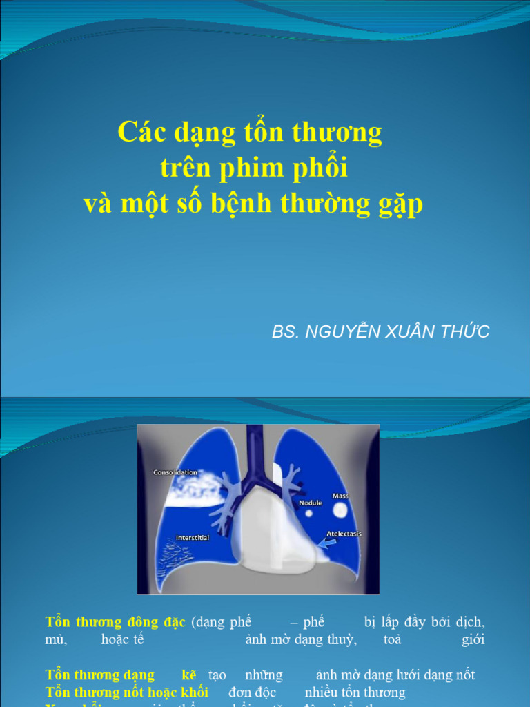 Cac Dang Ton Thuong Tren Phim Phoi Va Mot So Benh Thuong Gap | PDF