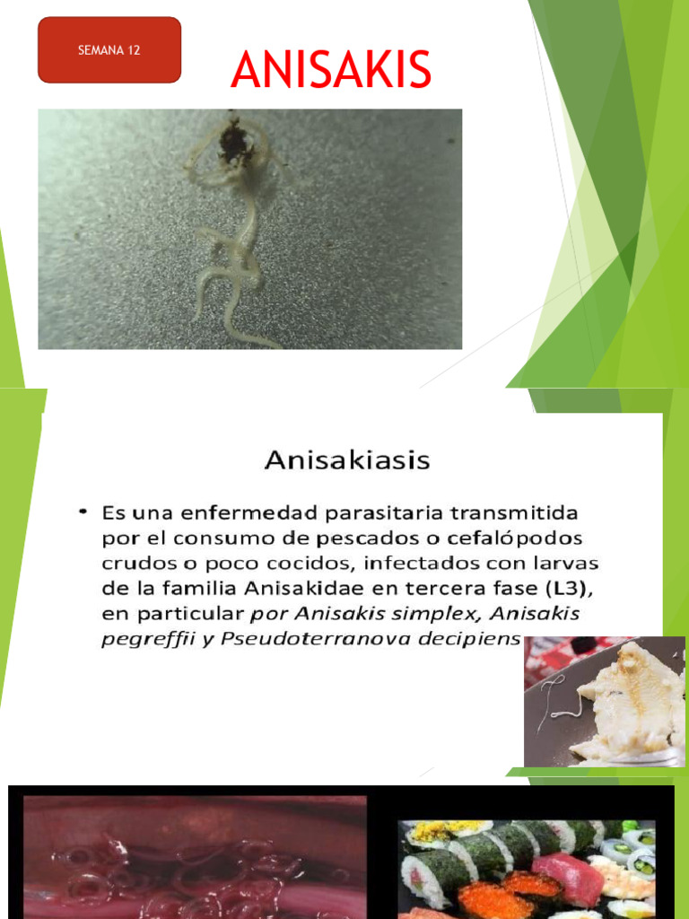 Anisakis 12 | PDF