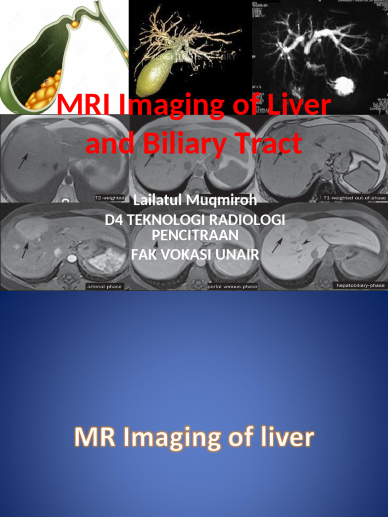 MRI Imaging of Liver and Biliary Tract | PDF | Magnetic Resonance ...