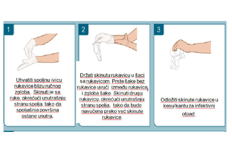 Skidanje Rukavica | PDF