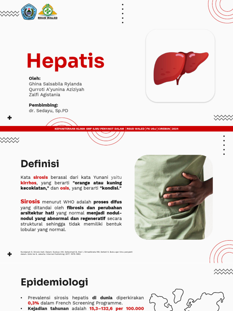 Sirosis Hepatis | PDF