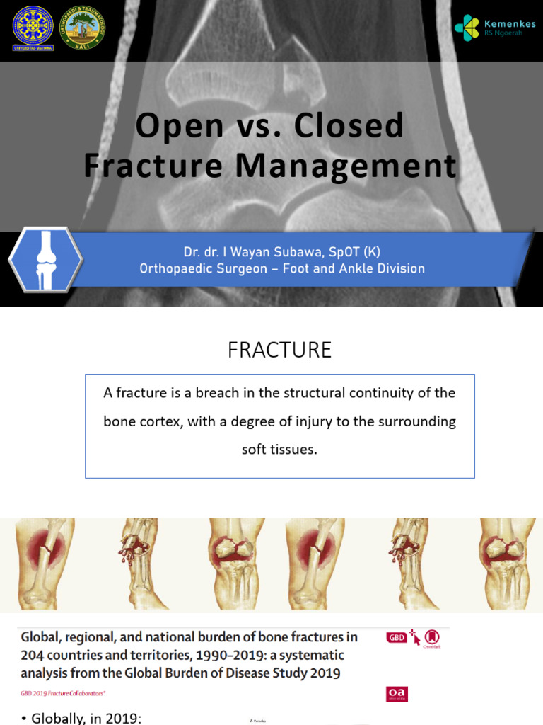 Open vs. Closed Fracture Management: Dr. Dr. I Wayan Subawa, Spot (K ...