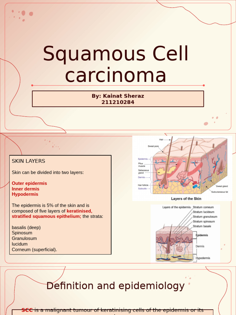 Scc | PDF | Biopsy | Epidermis