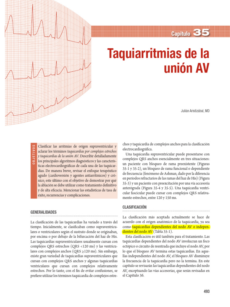 Taquiarritmias de La Union AV | PDF | Electrocardiografia ...