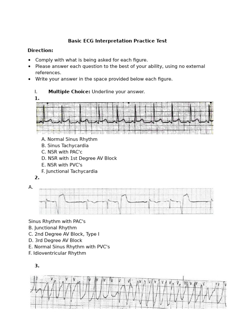Basic ECG Interpretation Practice Test | PDF
