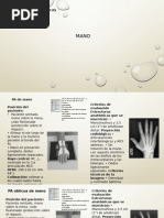 Técnicas Radiográficas de Mano 2023 | PDF | Mano | Extremidades (anatomía)