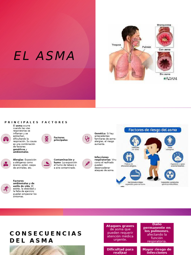 Factores y Consecuencias del Asma | PDF | Asma | Alergia