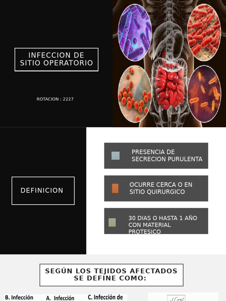 Infección de Sitio Quirúrgico: Guía y Reporte | PDF