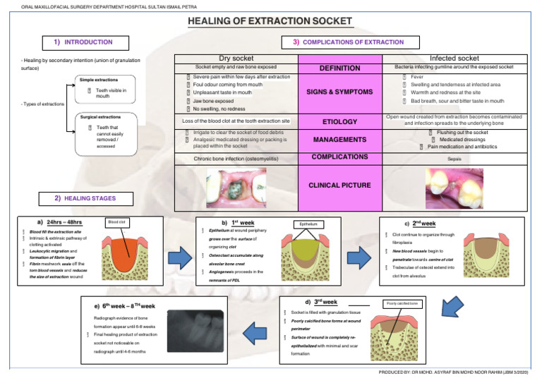 Extraction Socket 2.0 | PDF