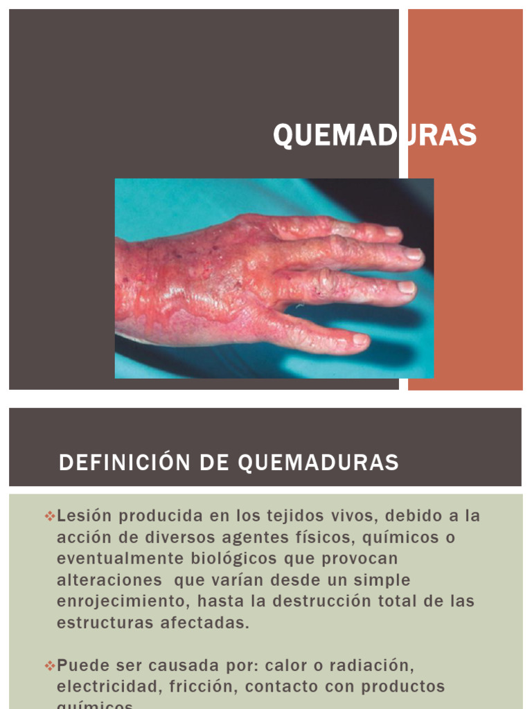 Guía Completa sobre Quemaduras y Tratamientos | PDF | Quemar | Piel