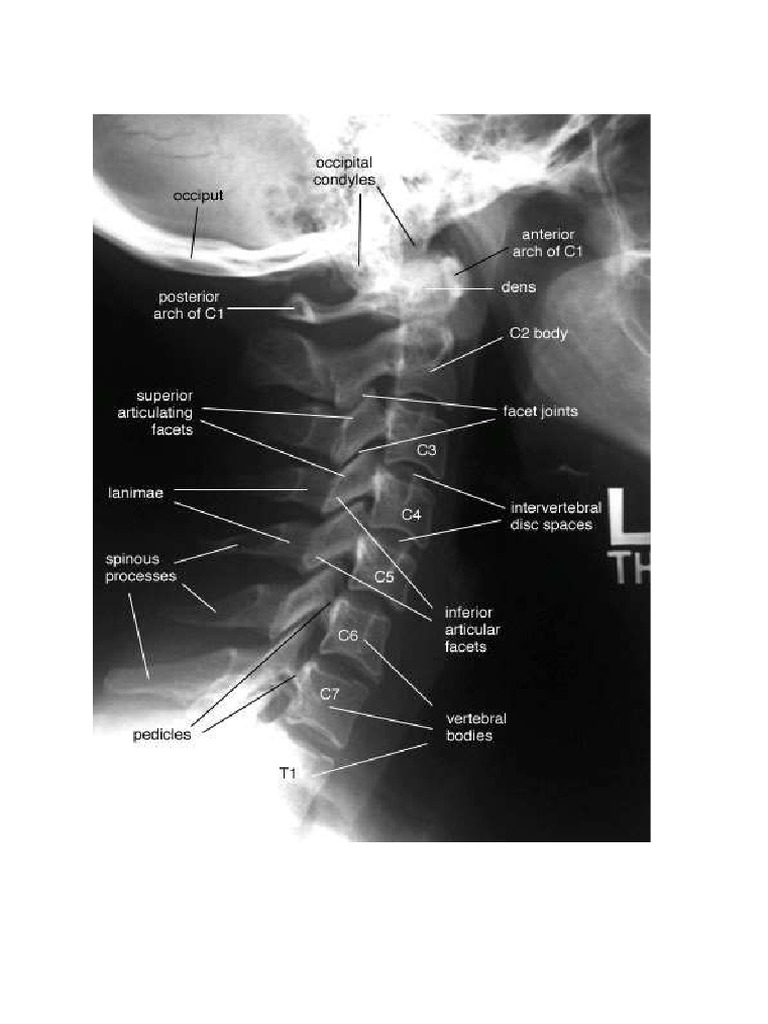 X-RAYS 2nd Year | PDF