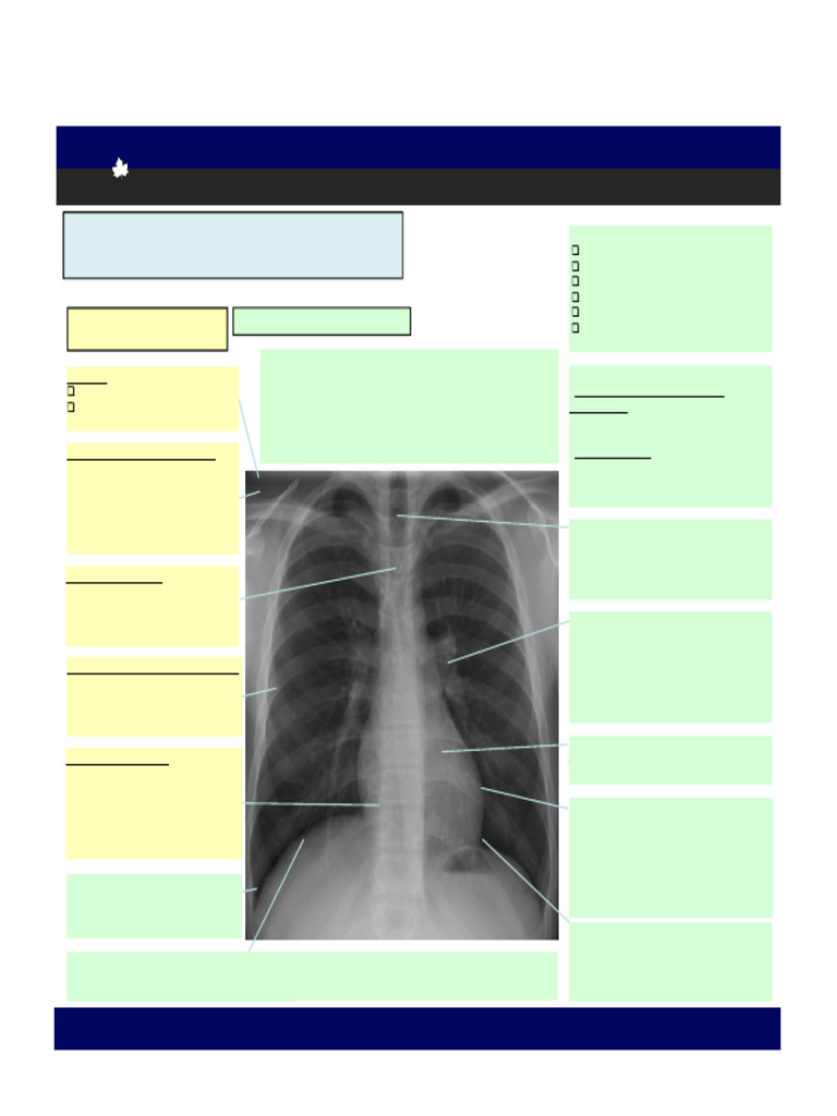 Chest X-Ray Interpretation Guide | PDF | Lung | Respiratory System