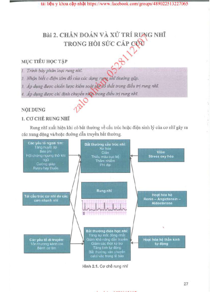 Chẩn Đoán Và Xử Trí Rung Nhĩ Trong HSCC - Điện Tâm Đồ Và Siêu Âm Tim Trong HSCC Tim Mạch BV Chợ ...