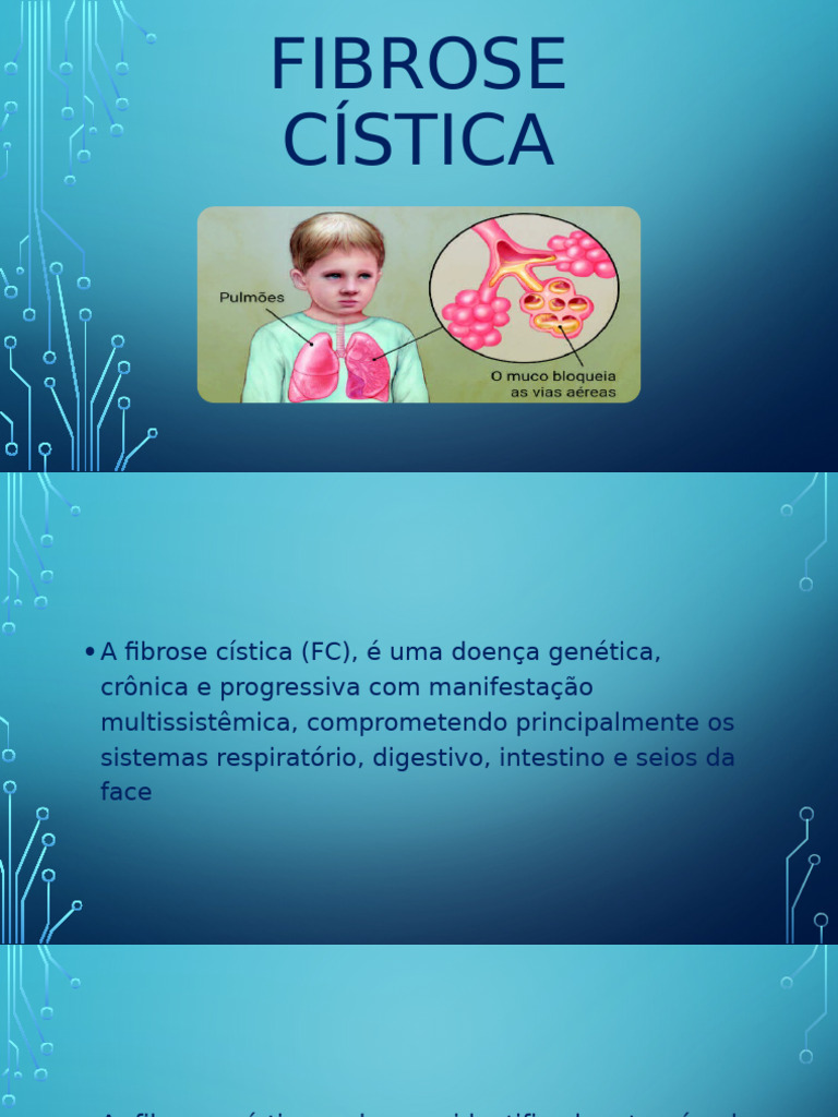 Fibrose Cística: Sintomas e Tratamento | PDF