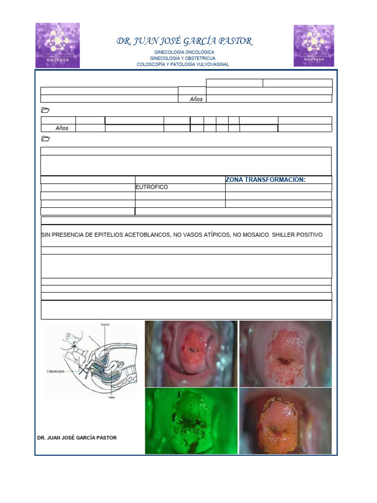 Informe Colposcopia Brenda Noemi Angeles Blanco 2 | PDF