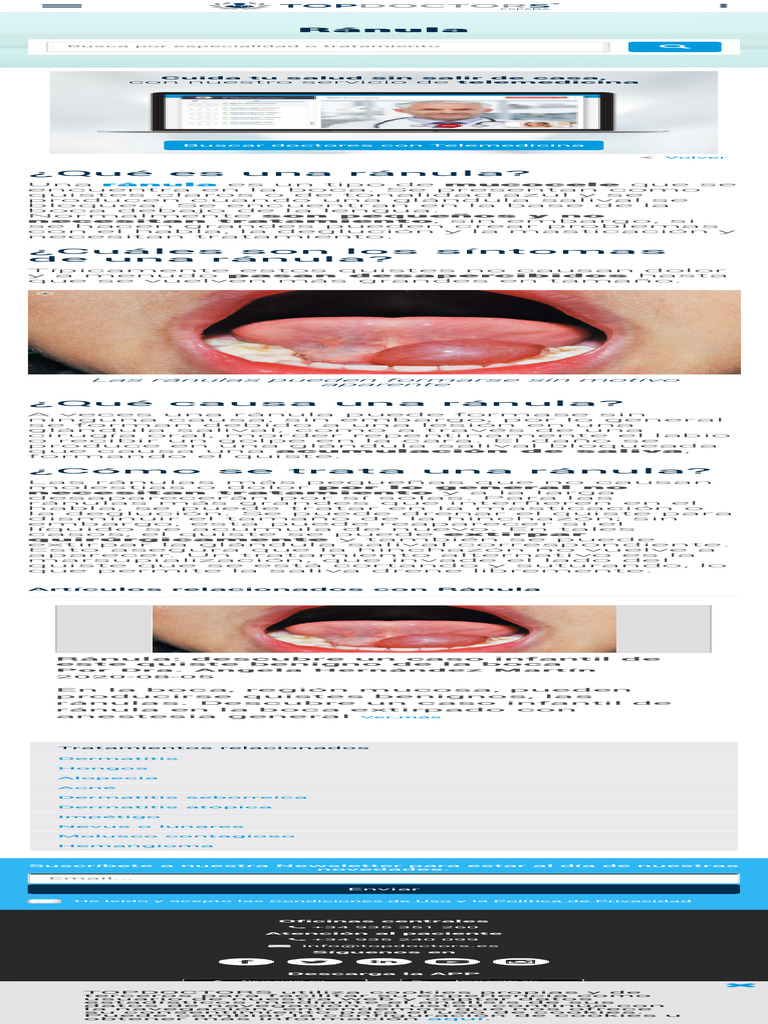Causas y tratamiento de ránulas | PDF | Medicina CLINICA | Enfermedades ...